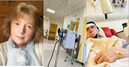 The Changing Faces of Cancer- Scalp cooling, Hair loss and Regrowth ...